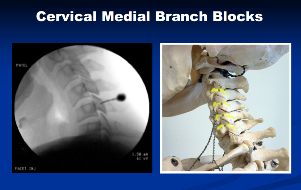 Services - Idaho Spine & Pain