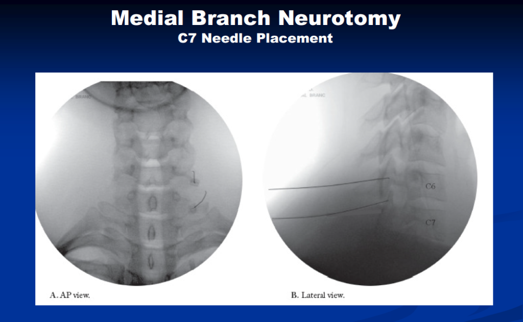 Services - Idaho Spine & Pain
