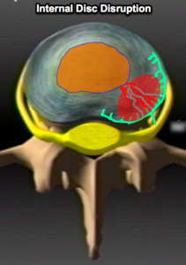 Services - Idaho Spine & Pain