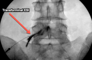 Services - Idaho Spine & Pain