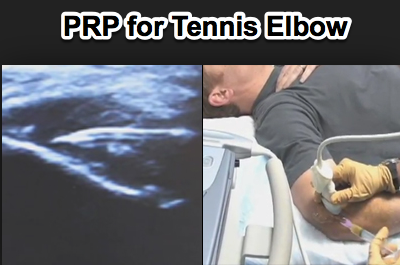 Services - Idaho Spine & Pain